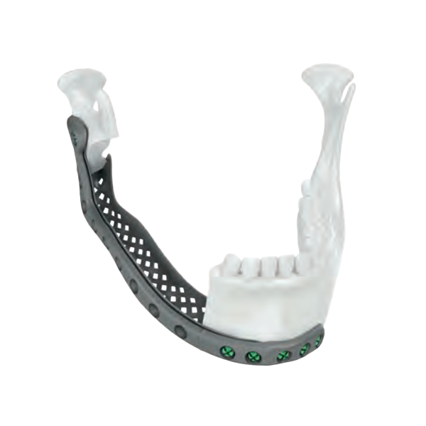 IPS - Individual Patient Solutions - Flexlab